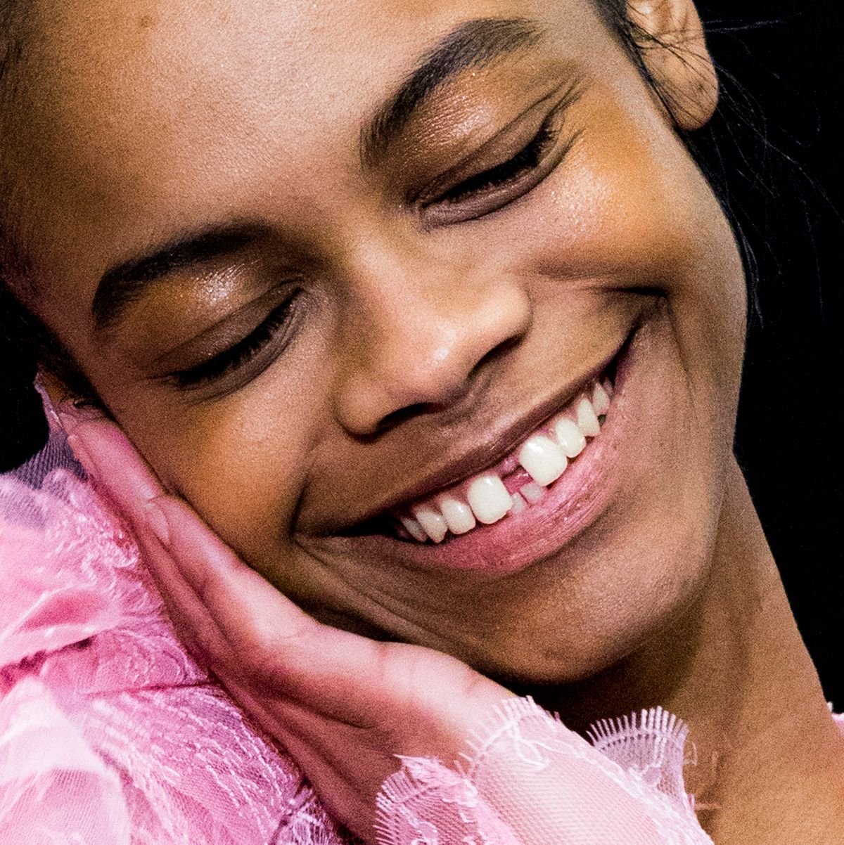 Clear Aligners for Diastema; Does This Work at All?